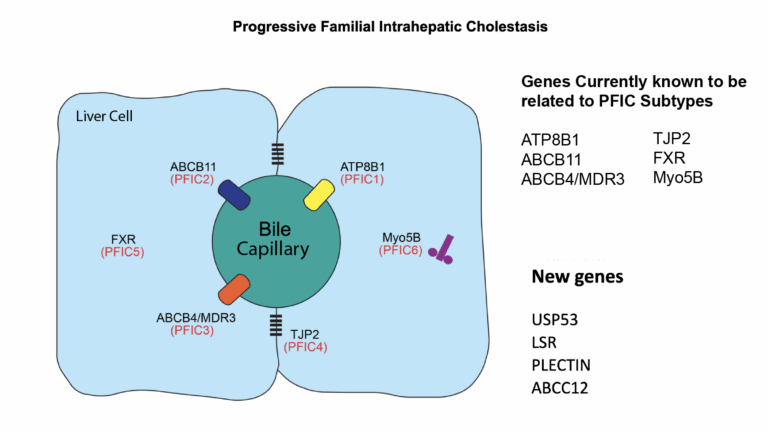 PFIC Types of PFIC - PFIC Network